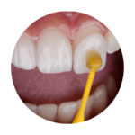 Synergy Dental – A new smile in just one day